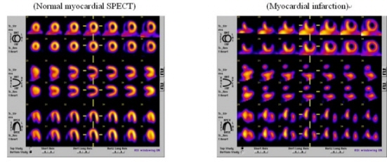 3) Other nuclear images